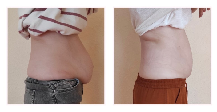 Tupler Technik® & Rektusdiastase - Dein Körperglück